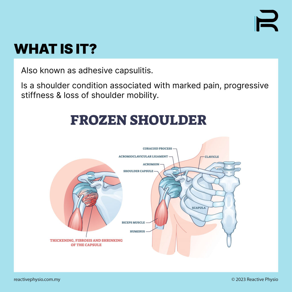Defeating Frozen Shoulder with Reactive Physio’s Expert Care – Reactive ...